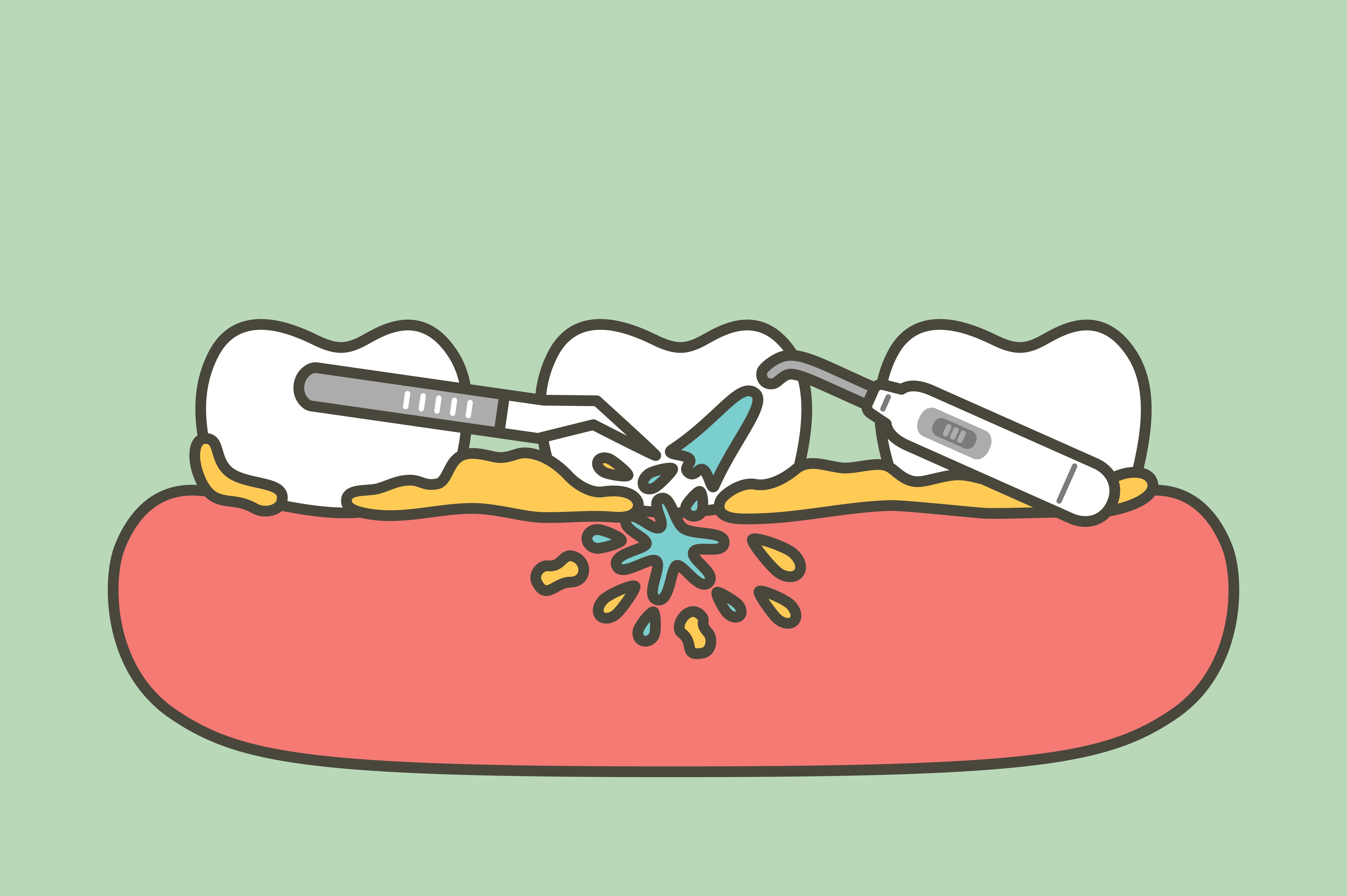 What Does It Mean If You Have White Stuff On Your Gums? - Patient ...