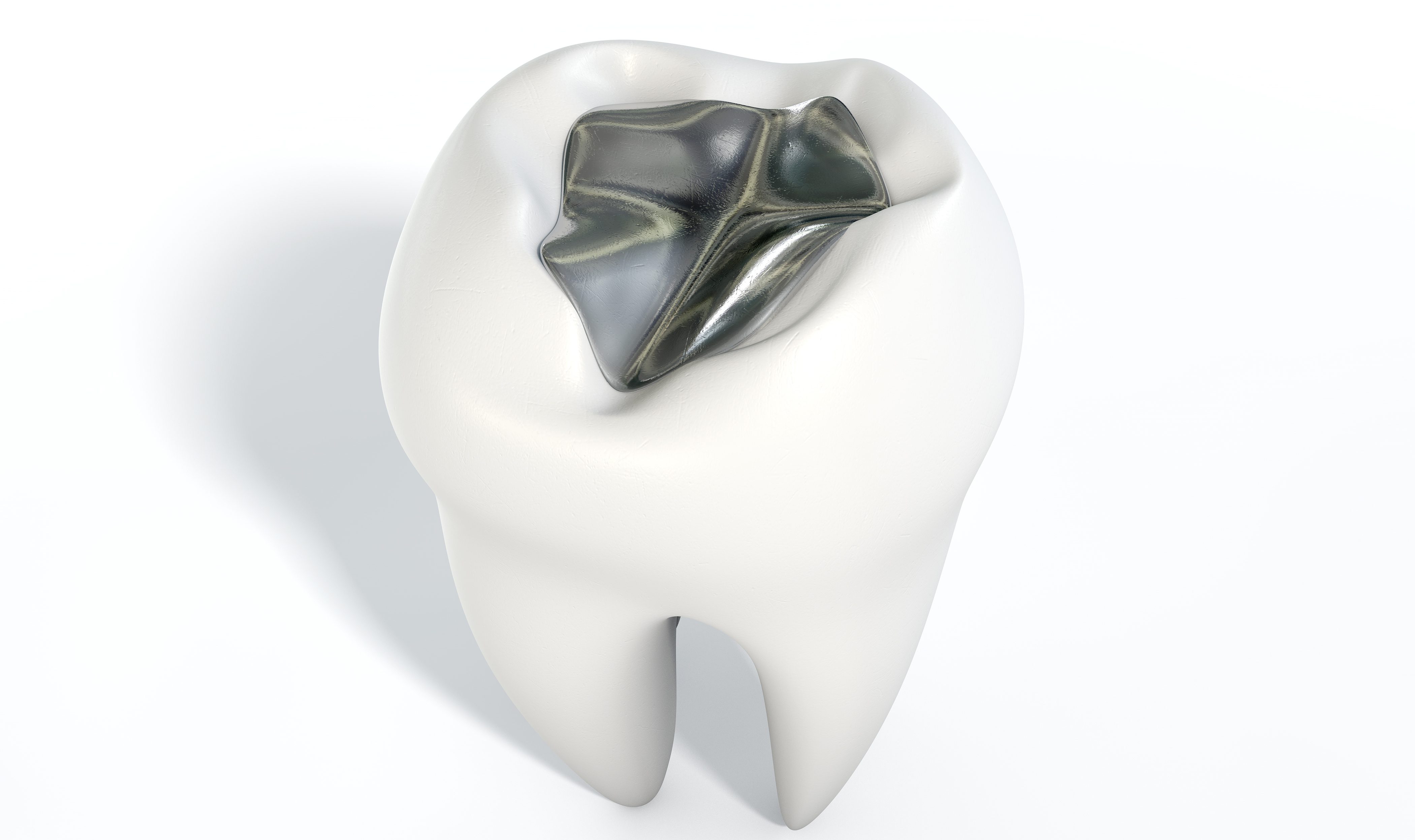 Dental Filling Fell Out? Discover a Temporary Fix (2024 Update ...